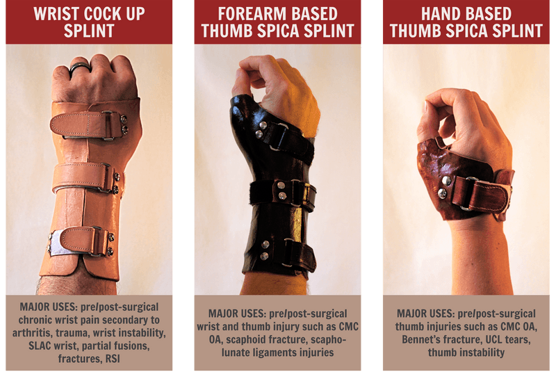 Our Splints - leatherworkssplinting Our Splints - leatherworkssplinting